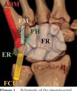 Hamate Bone: Anatomy, Imaging, and Pathologic Conditions